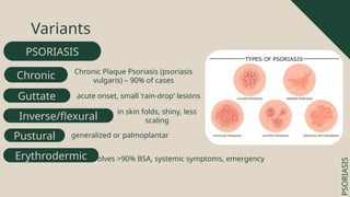 Basics of Psoriasis for Medical Students | PPTX