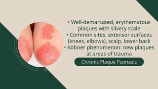 Basics of Psoriasis for Medical Students | PPTX