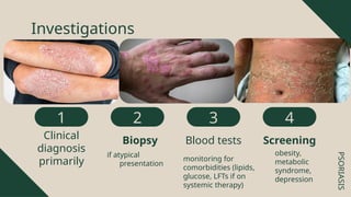 Basics of Psoriasis for Medical Students | PPTX