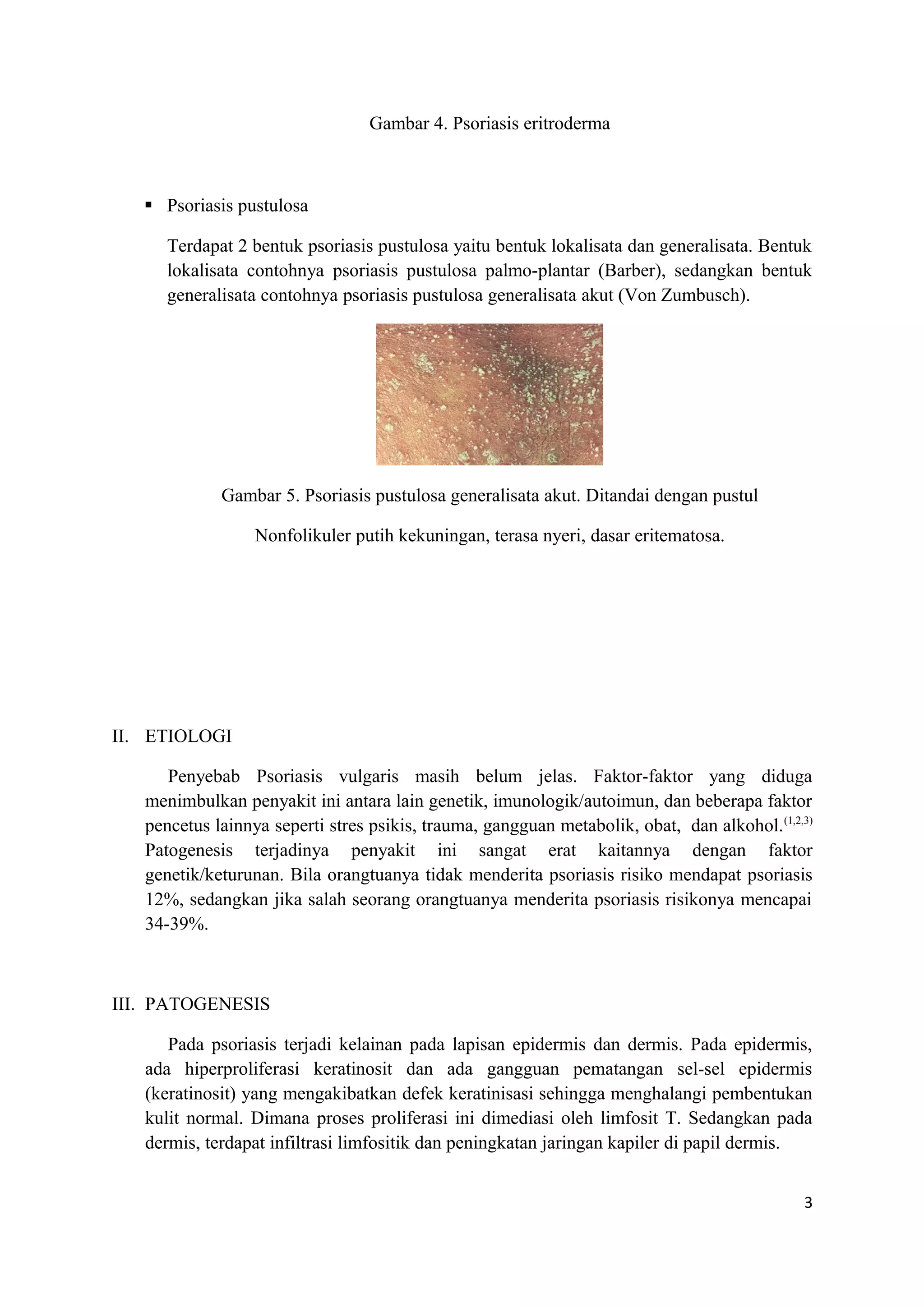Psoriasis vulgaris | DOC