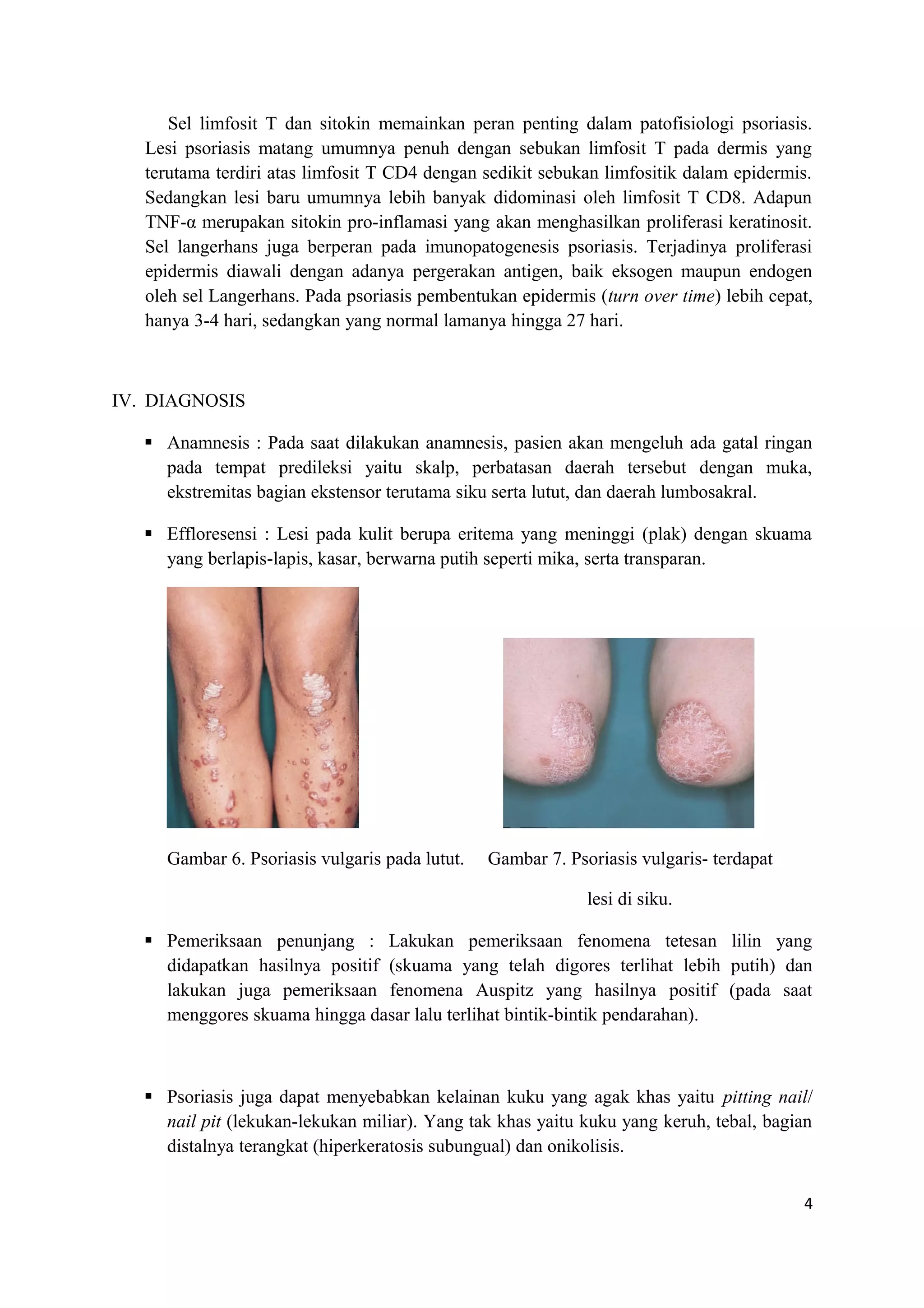 Psoriasis vulgaris | DOC