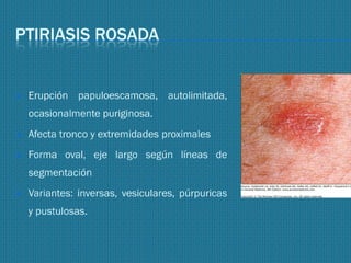 Psoriasis y pitiriasis rosada | PPTX