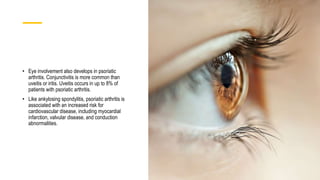 Psoriathic arthritis-Diagnosis and Management | PPTX