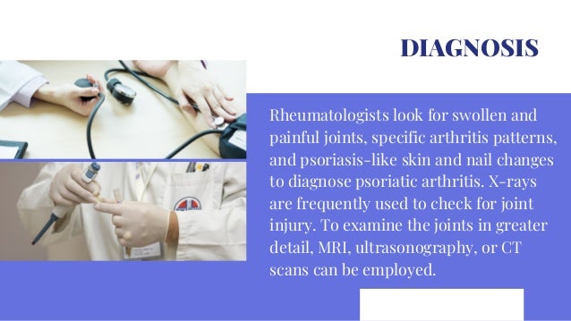 psoriatic arthritis specialist in Coimbatore | PPT