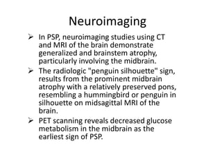 Psp - Progressive Supranuclear Palsy | PPTX