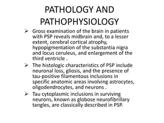 Psp - Progressive Supranuclear Palsy | PPTX