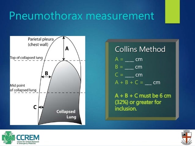 Primary Spontaneous Pneumothorax Study