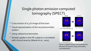 Psp 3 presentation parkinsons | PPT