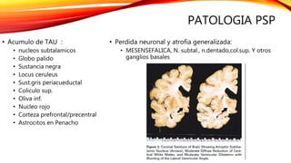PARALISIS SUPRANUCLEAR PROGRESIVA,DEGENERACION CORTICOBASAL, ATROFIA ...