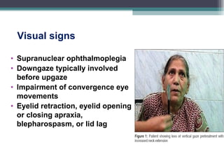 Progressive supranuclear palsy presentation | PPT