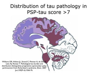 Psp Richardson | PPT