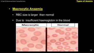 Anemia its types , causes , clinical findings | PPTX | Blood Disorders ...