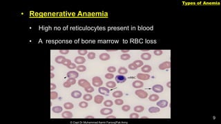 Anemia its types , causes , clinical findings | PPTX | Blood Disorders ...