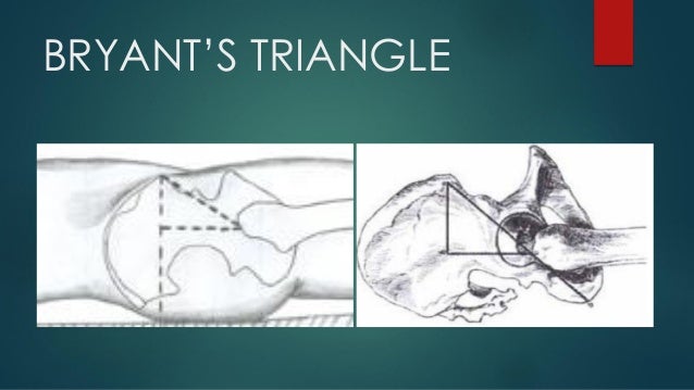 PS SESSION : EXAMINATION OF HIP