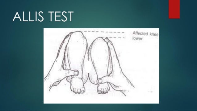 PS SESSION : EXAMINATION OF HIP