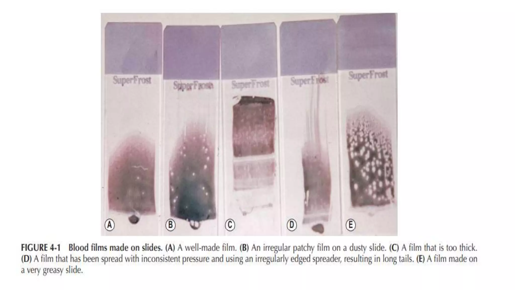 Peripheral smear STAINING.pptx