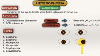 Psudo & latent squint | PPT