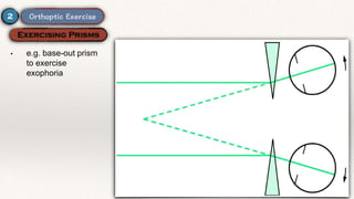 Psudo & latent squint | PPTX