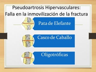 Las pseudoartrosis ocurren cuando el hueso carece de estabilidad | PPTX