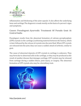Psuedo Gout Treatment | PDF