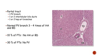Portosinusoidal Vascular Disease (PSVD) | PPTX