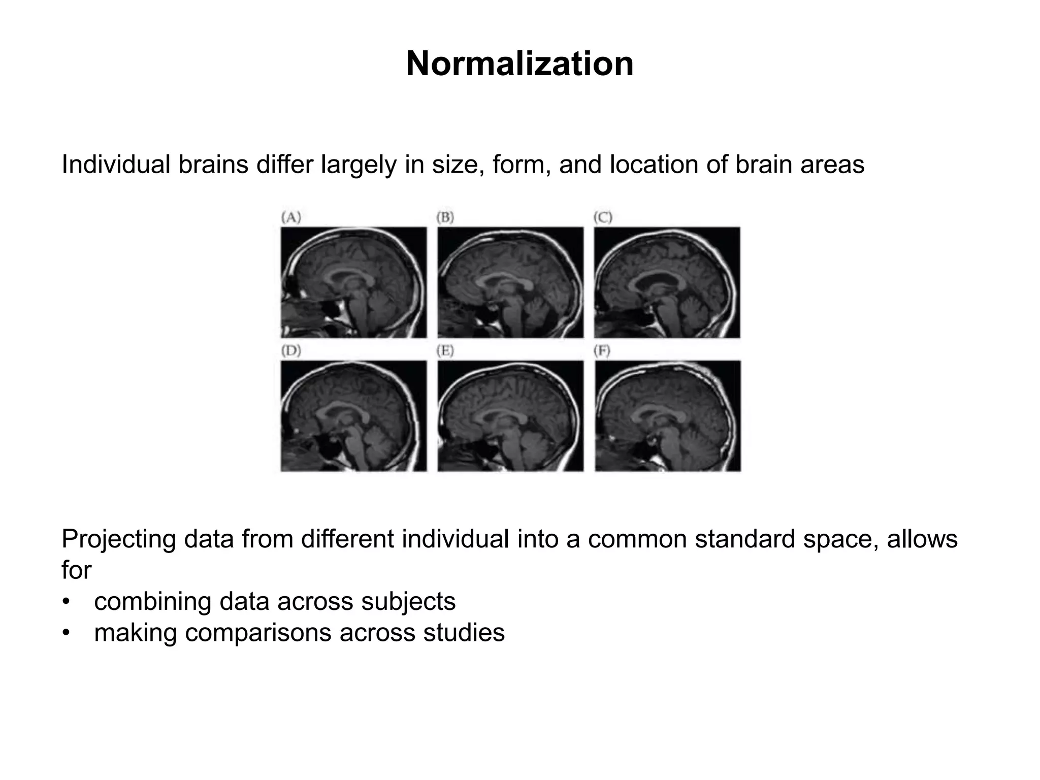 Introduction to fMRI | PPTX
