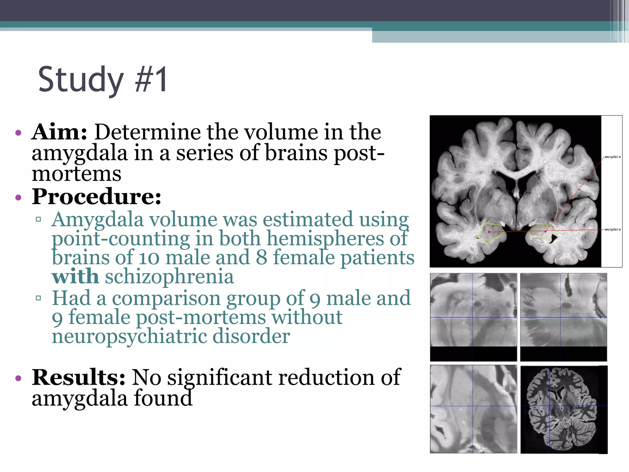 Psych Amygdala Presentation | PPT
