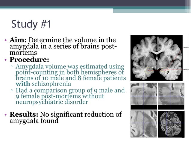 Psych Amygdala Presentation | PPT