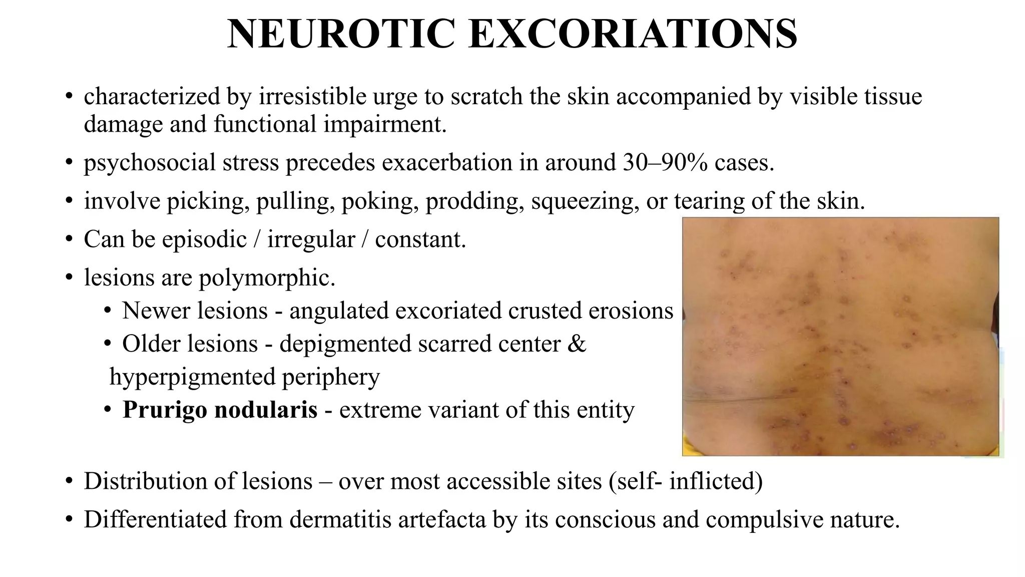 Psychocutaneous disorders.pptx