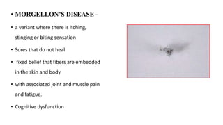 Psychocutaneous disorders.pptx