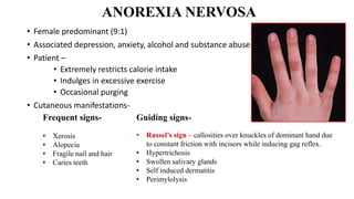 Psychocutaneous disorders.pptx