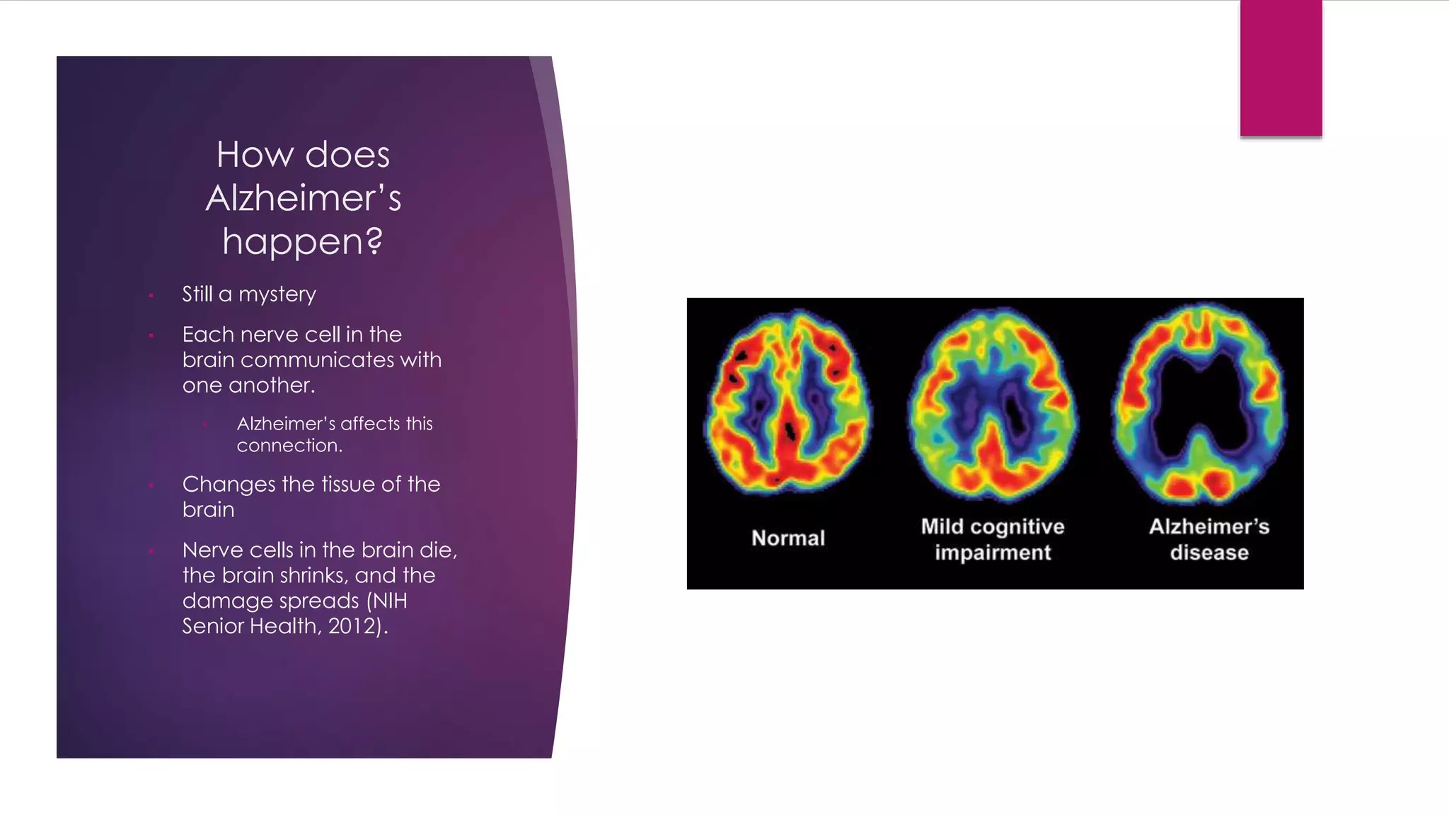 Psychology alzheimer's powerpoint | PPTX