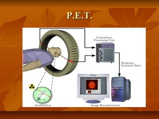 Physiological measurements | PPS
