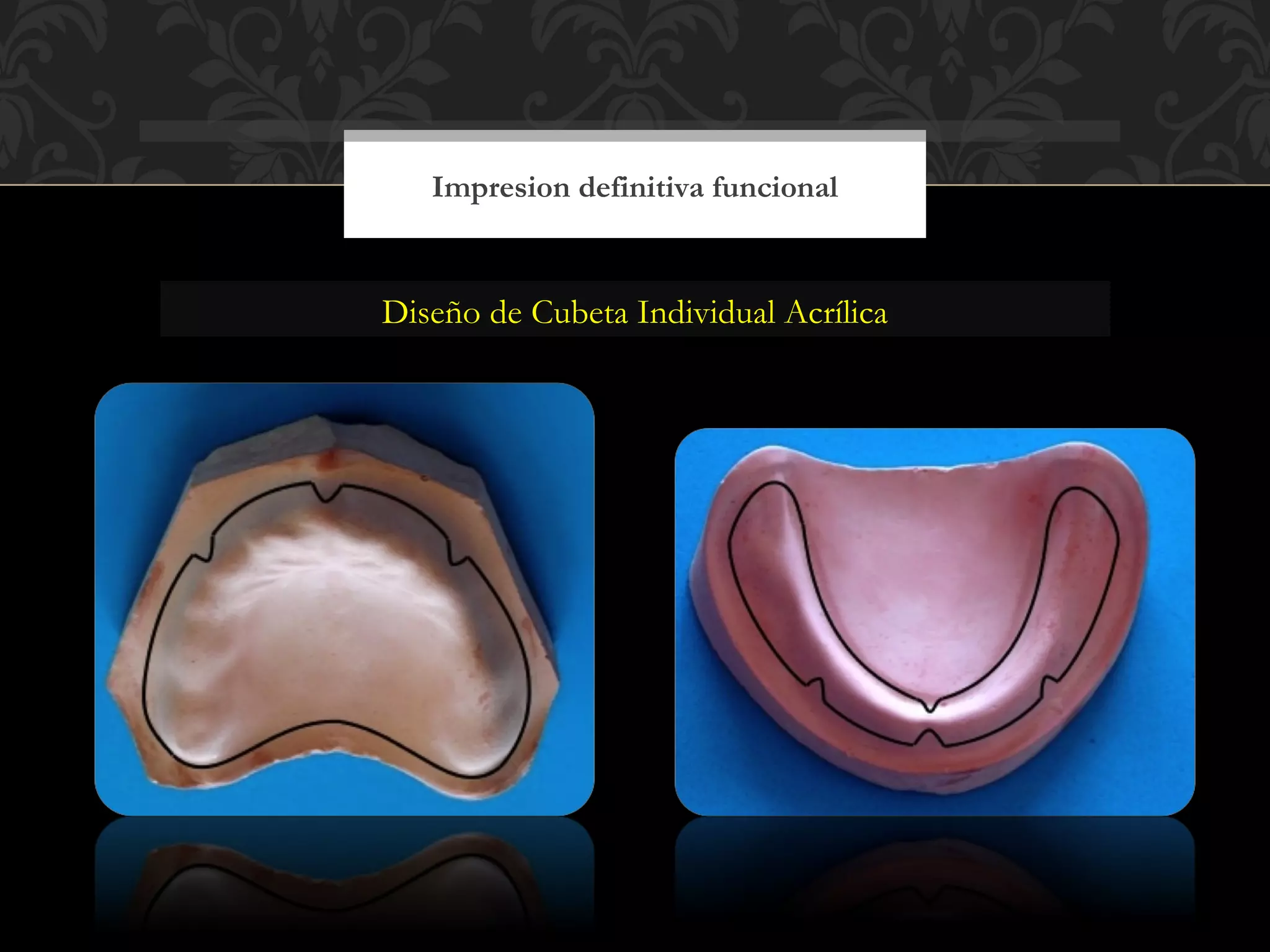Impresion Definitiva en Protesis Total | PPT