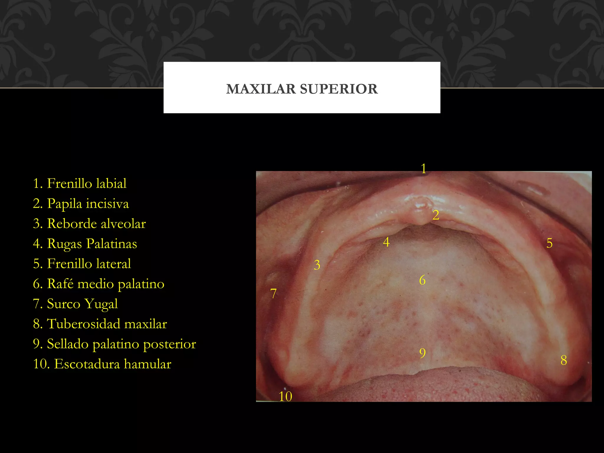 Impresion Definitiva en Protesis Total | PPT