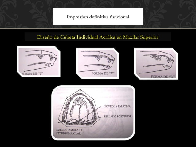 Impresion Definitiva en Protesis Total | PPT