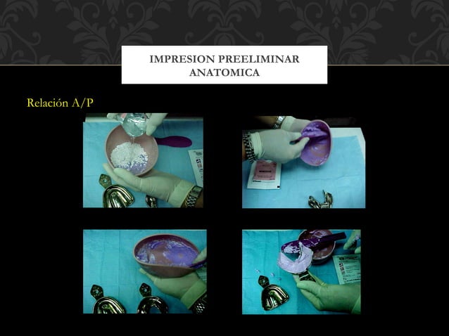 Impresion Definitiva en Protesis Total | PPT