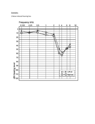 Pure Tone Audiometry | PDF