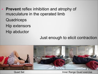 Physiotherapy Rehab After Total Hip Replacement | PPTX