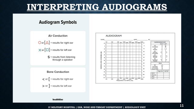 PTA Presentation.pptx a presentation on Pure Tone Audiometry | PPT