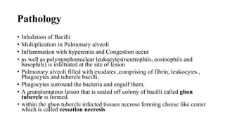 Pulmonary Tuberculosis | PPT