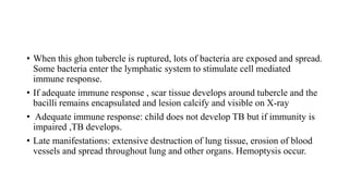 Pulmonary Tuberculosis | PPT