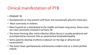 Pulmonary tuberculosis latest guidelines and treatment | PPTX