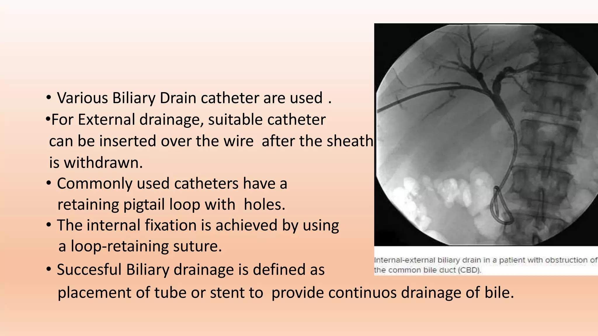 PTBD (Percutaneus trans-hepatic biliary drainage) PPT,PDF PK | PPTX