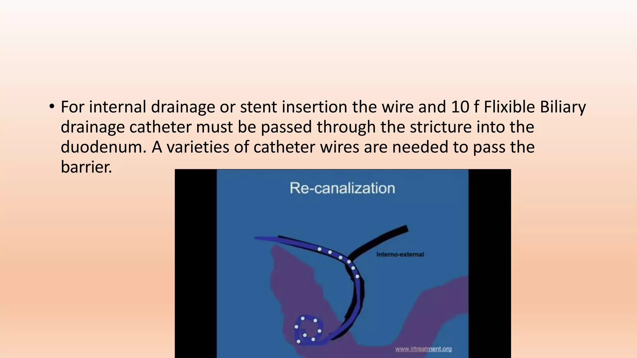 PTBD (Percutaneus trans-hepatic biliary drainage) PPT,PDF PK | PPTX