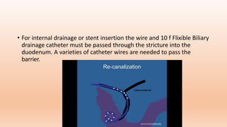 PTBD (Percutaneus trans-hepatic biliary drainage) PPT,PDF PK | PPTX