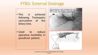 PTBD (Percutaneus trans-hepatic biliary drainage) PPT,PDF PK | PPT