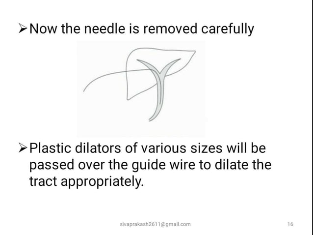 PTBD Percutaneous transhepatic biliary drainage | PPTX | Surgery ...