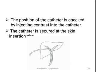 PTBD Percutaneous transhepatic biliary drainage | PPTX