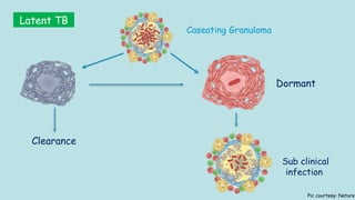 Pulmonary Tuberculosis, Integrated teaching Dr Naila.pptx